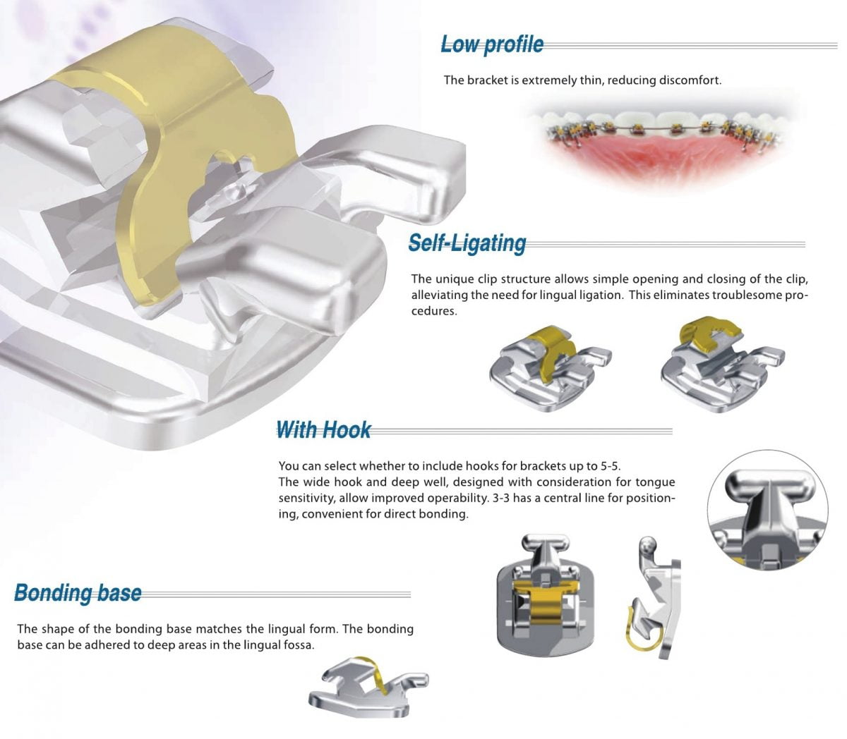 CLIPPY L LINGUAL SL BRACKETS - ORTHOMAX Australia