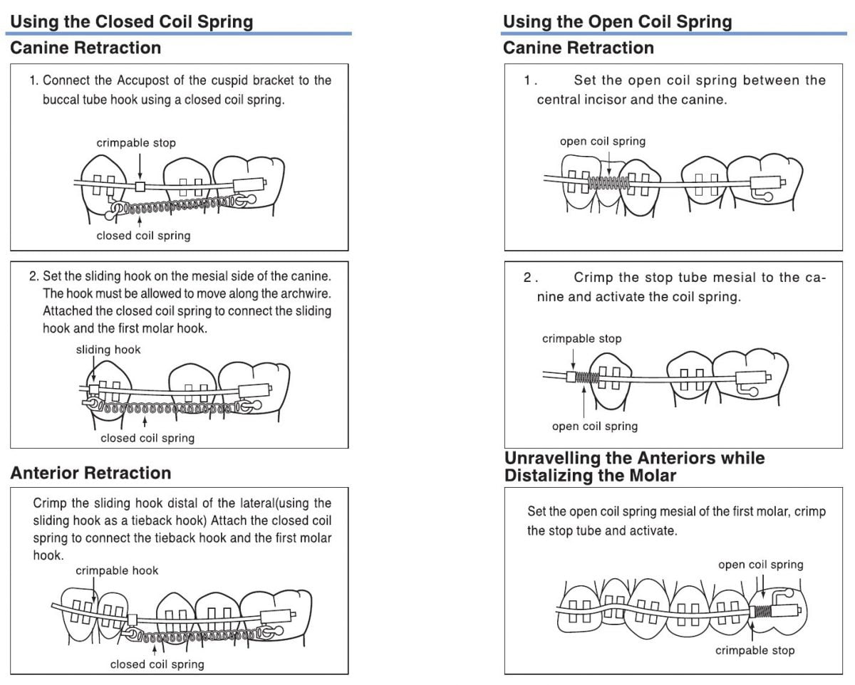 SENTALLOY SUPER ELASTIC SPOOLED OPEN SPRINGS - ORTHOMAX Australia