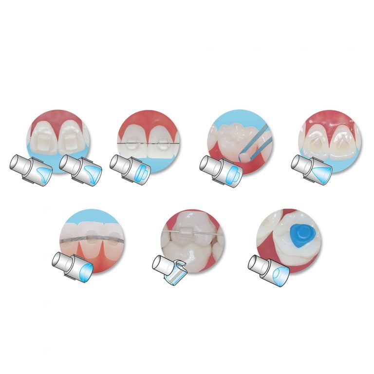 MINI MOLD TIPS - ORTHOMAX Australia