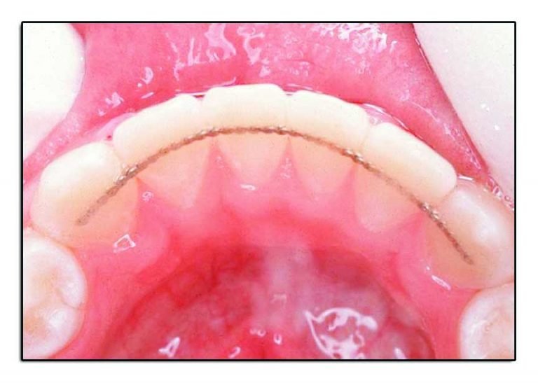 ORTHO FLEXTECH - ORTHOMAX Australia